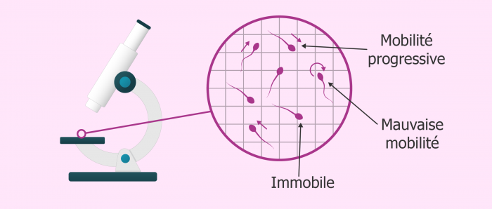 COMPRENDRE LE SPERMOGRAMME – Médecine, Science et Recherche