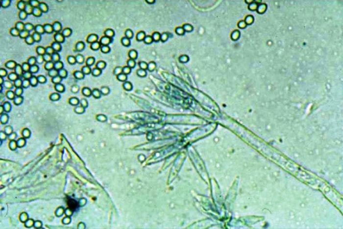 CONNAITRE LES MYCOSES PAR CHAMPIGNONS ET LEVURES – Médecine, Science et ...
