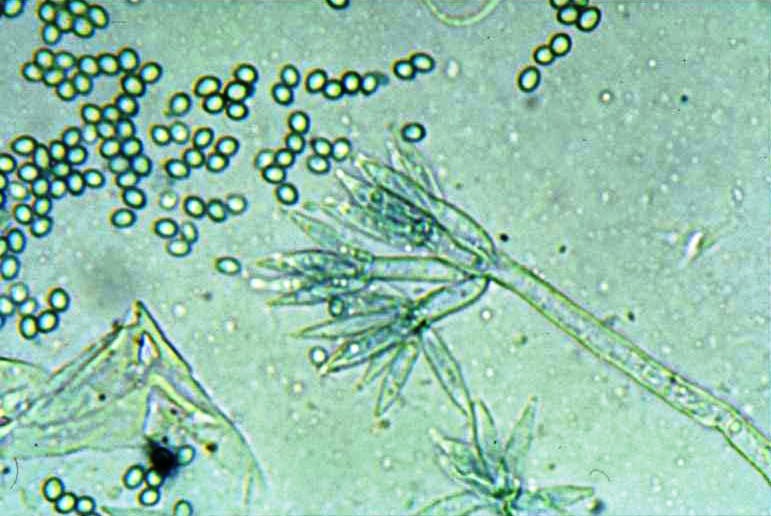 CONNAITRE LES MYCOSES PAR CHAMPIGNONS ET LEVURES – Médecine, Science et ...