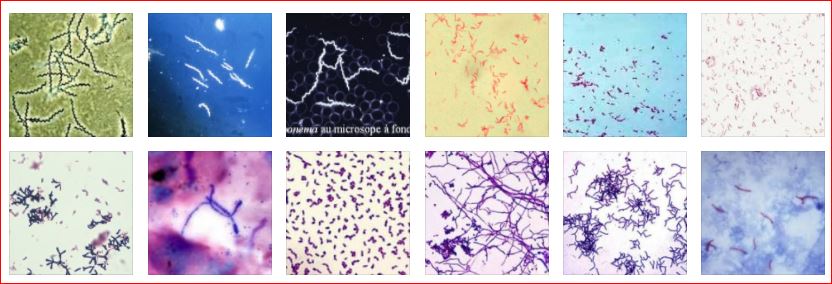 [:fr]LA BACTÉRIOLOGIE MÉDICALE - LES BACTÉRIES : PRÉSENTATION ...
