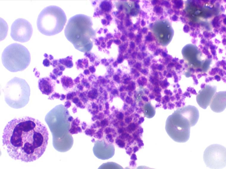 COMPRENDRE LA FORMULE ET NUMÉRATION SANGUINE – FNS – Médecine, Science ...